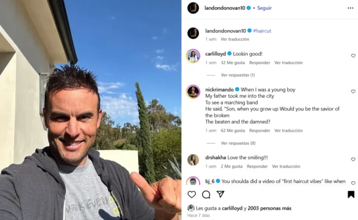 Landon Donovan reveló su lucha contra la calvicie y el tratamiento que ...